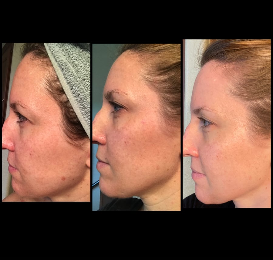 I'm Ecstatic About My Results [Aesthetics Testimonial]